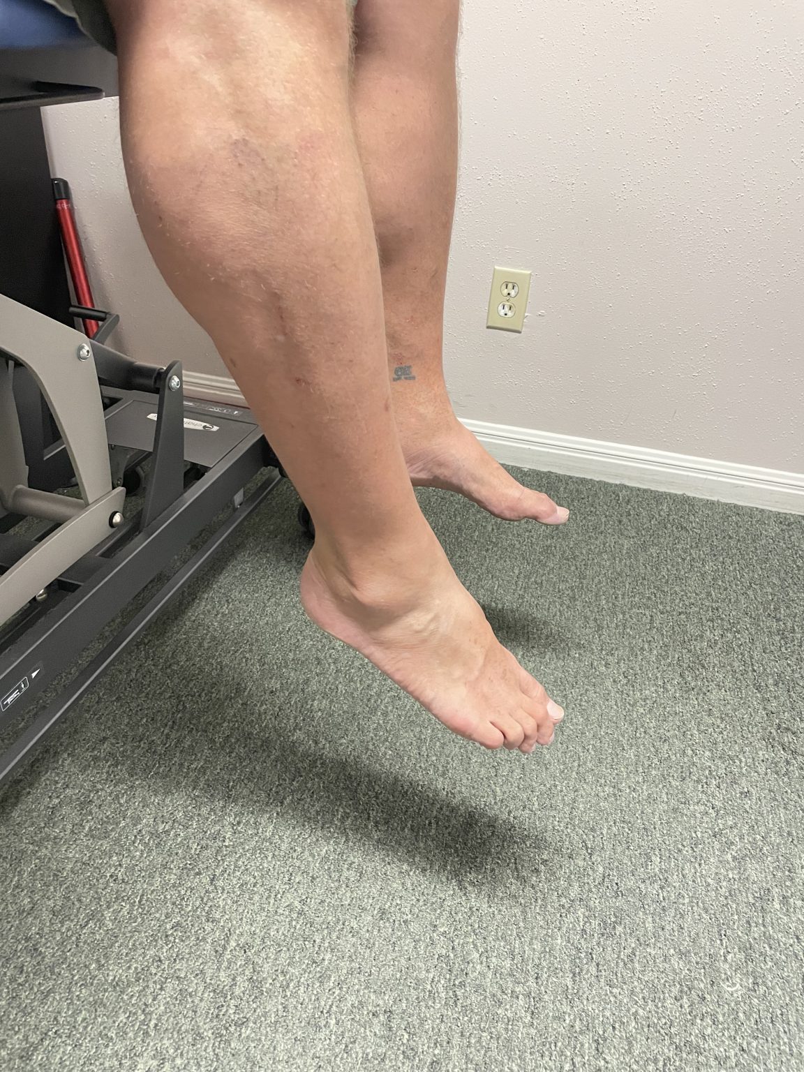 Foot Drag / Foot Drop? Dragging Leg While Walking? - CORE Therapy & Pilates